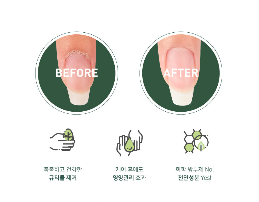 I'ZEMI Re:CURE Cuticle Gel [300ml] – Haeyo